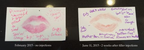 What is Lipsology - Lip Messages